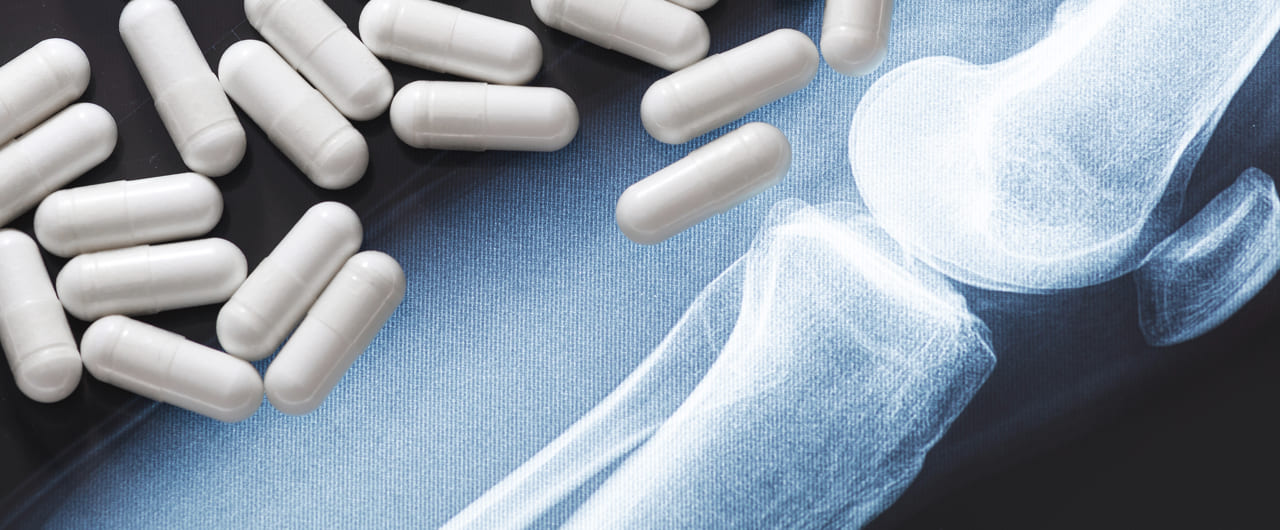 How to Take Glucosamine for Joint Pain Relief — Dosage, Timing, and Be